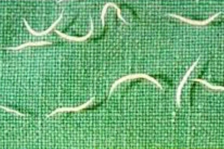 Mengenal Cacing Kremi: Penyebab dan Cara Mengobati